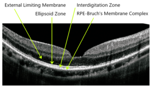第51回午前、視能訓練士国家試験の解答と解説⑥ | 眼の事に関する物